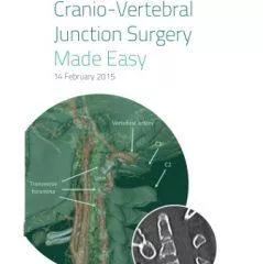 Cranio-Vertebral Junction Surgery | Aster Hospital Blogs